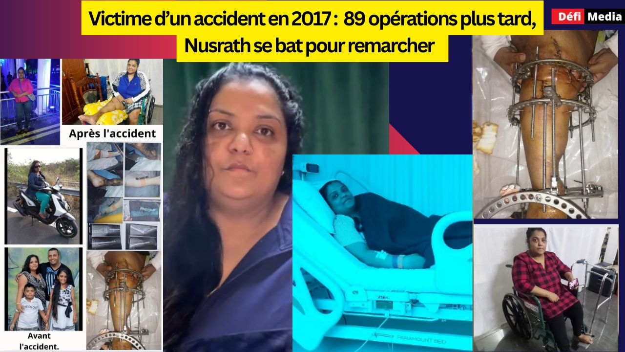 Victime d’un accident en 2017 : 89 opérations plus tard, Nusrath se bat ...